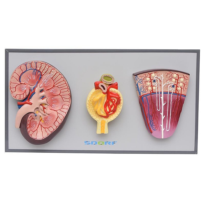 Modelo Anatômico do Rim, Néfrons e Glomérulos em Prancha - Planeta ...