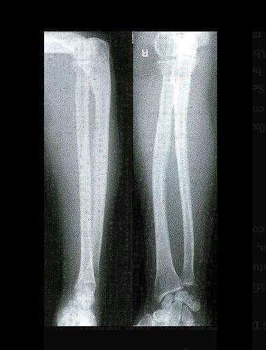 Rx do Antebraço (unilateral) - Orto Center