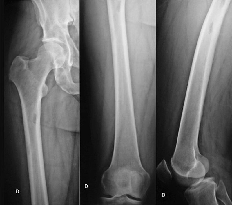 Rx do Fêmur/Coxa - Orto Center