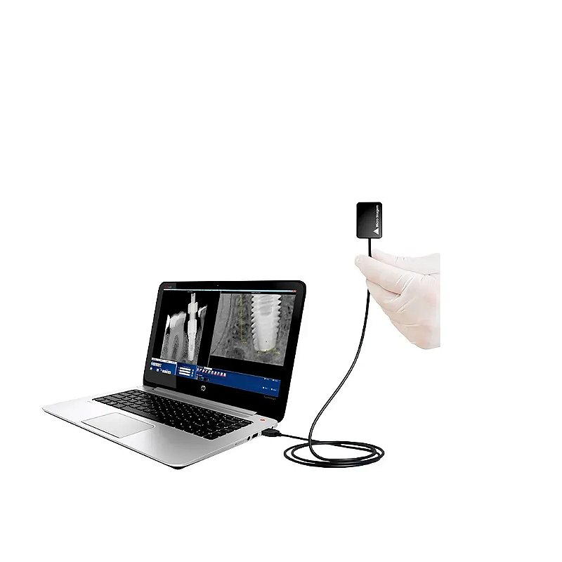 Sensor T1 Para Radiografia Digital Micro Imagem - Odonto Xique